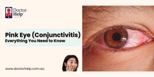 Pink Eye (Conjunctivitis): Causes, Symptoms & Treatment